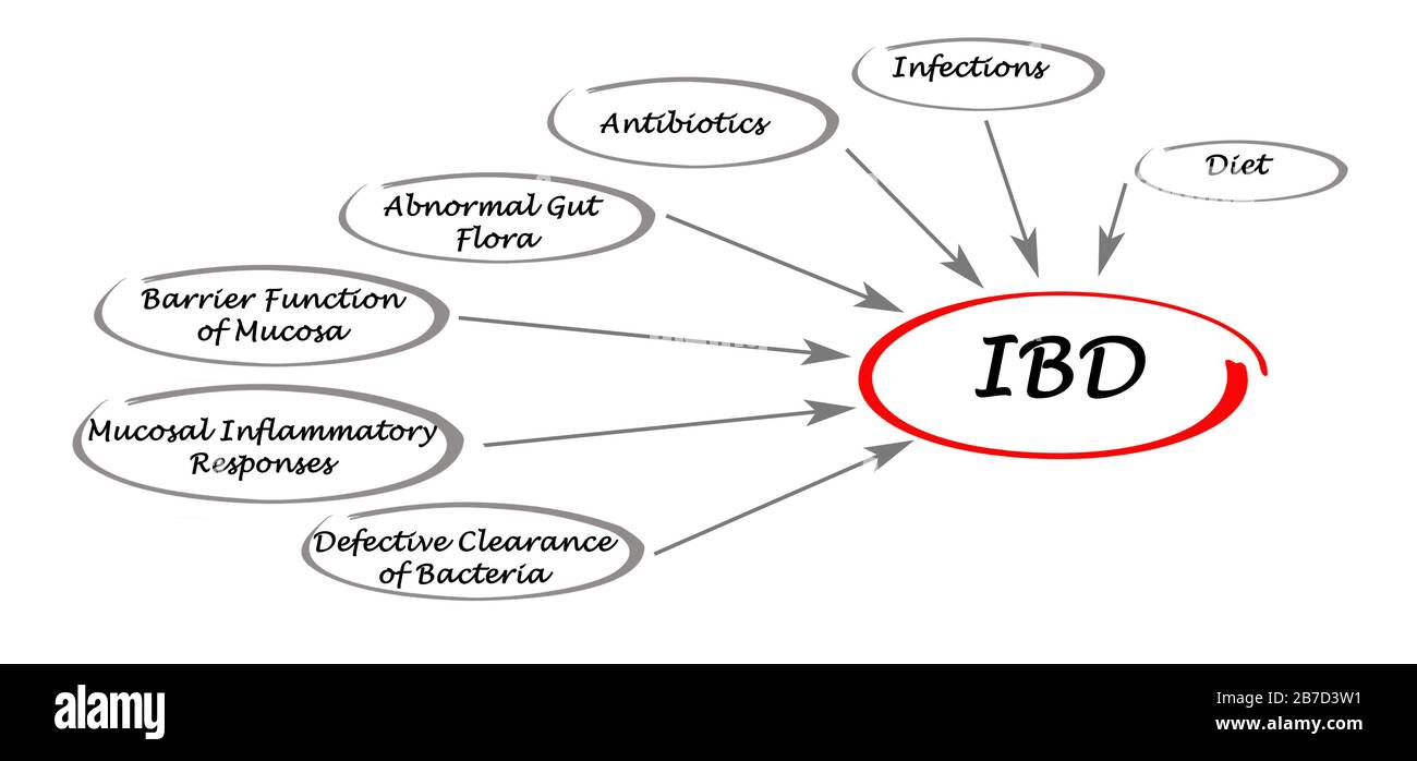 Causes of Inflammatory bowel disease Stock Photo - Alamy