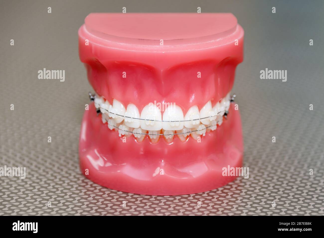 Orthodontic model and dentist tool - demonstration teeth model with ...