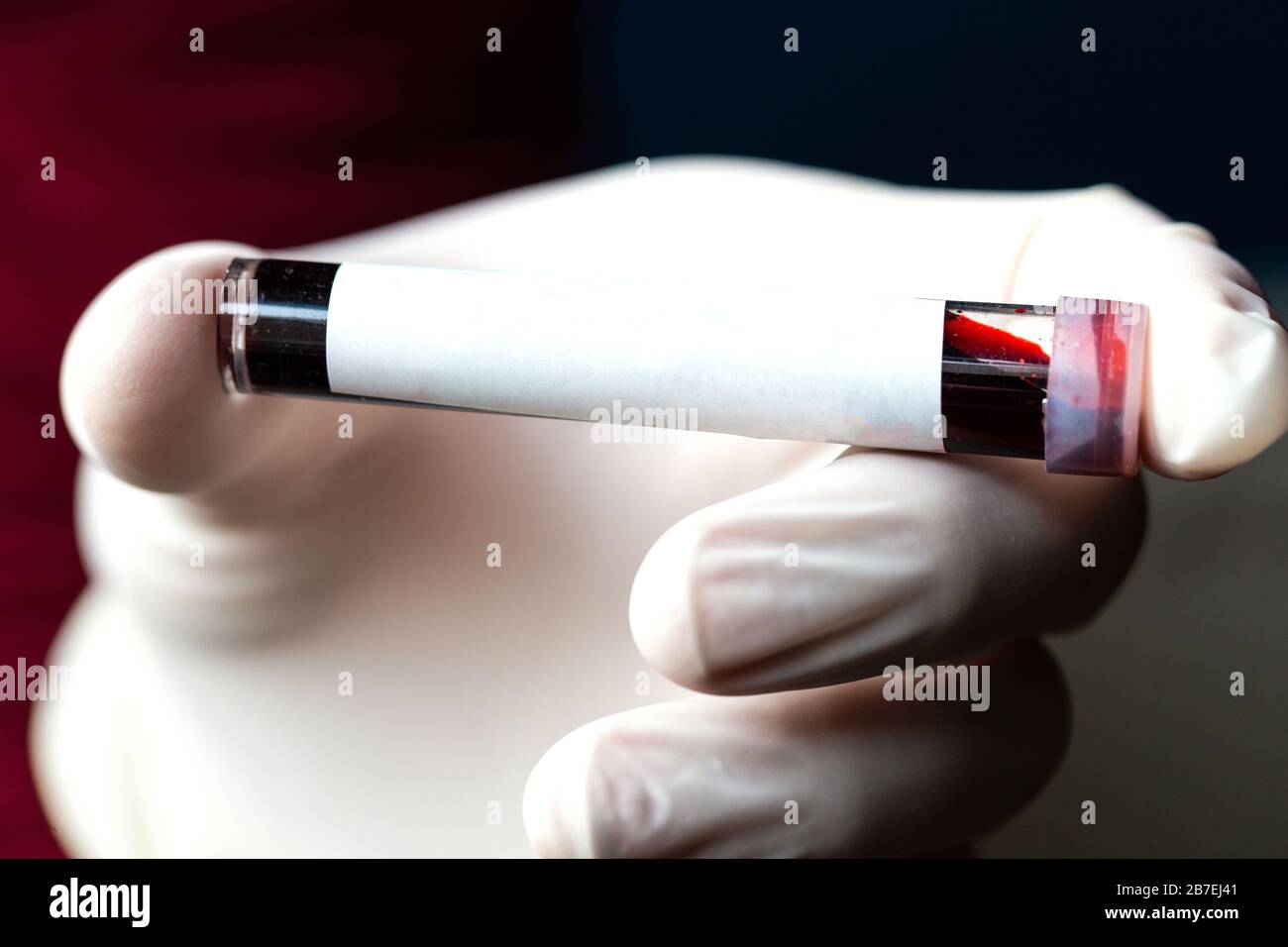 Blood sample label hi-res stock photography and images - Alamy
