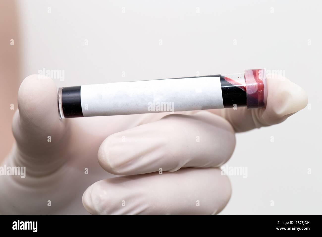 Blood sample label hi-res stock photography and images - Alamy