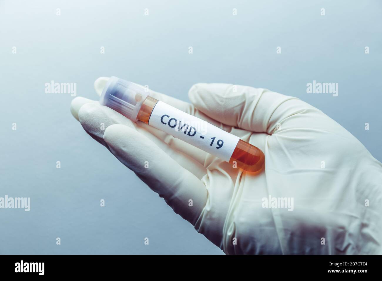Blood sample in virology hi-res stock photography and images - Alamy