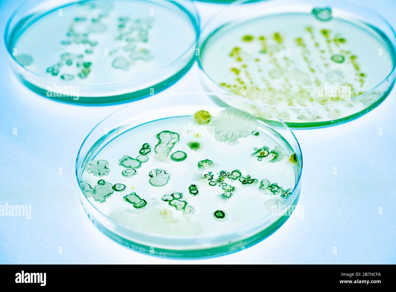 Petri Dish Bacteria Identification