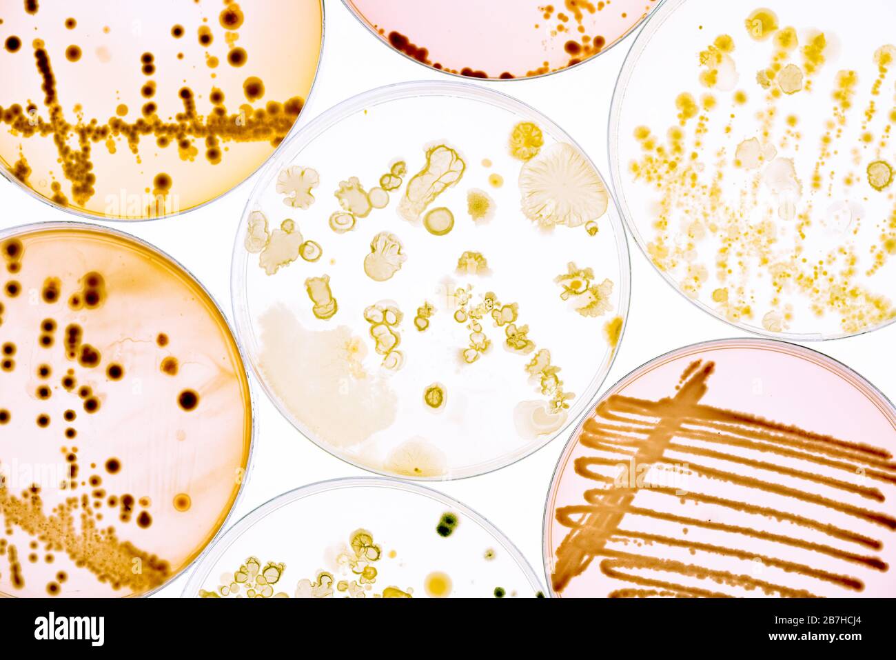 Growing Bacteria in Petri Dishes on agar gel Scientific experiment ...