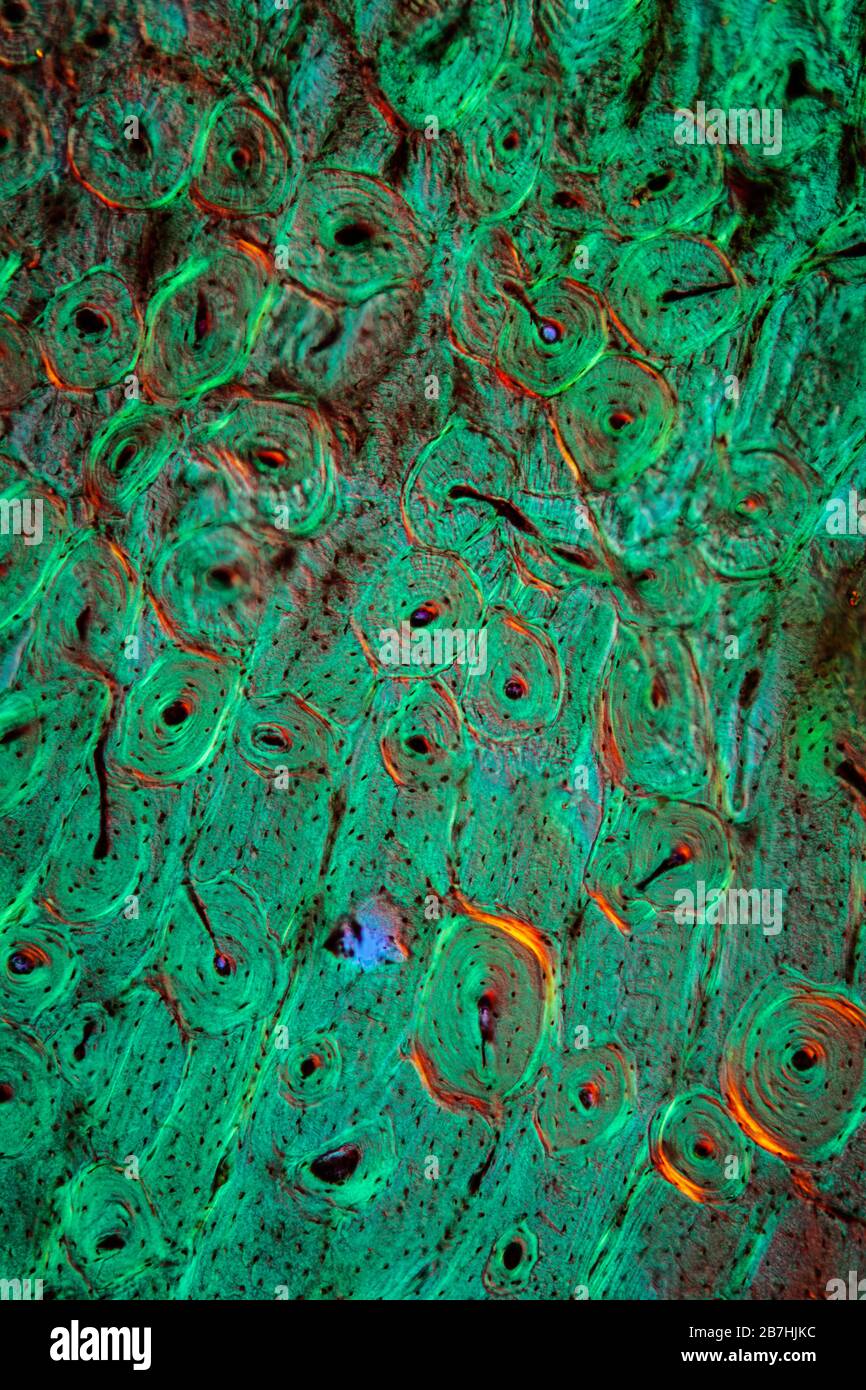 decalcified bone in cross section 100x Stock Photo - Alamy