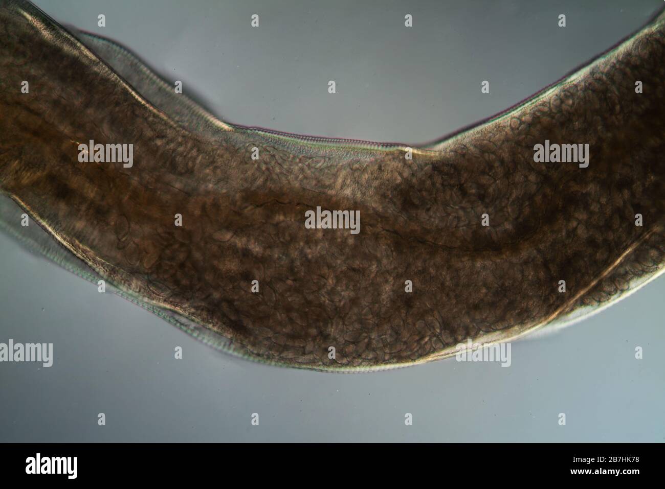 Oxiuris parasitic pinworm 100x under the microskope Stock Photo - Alamy