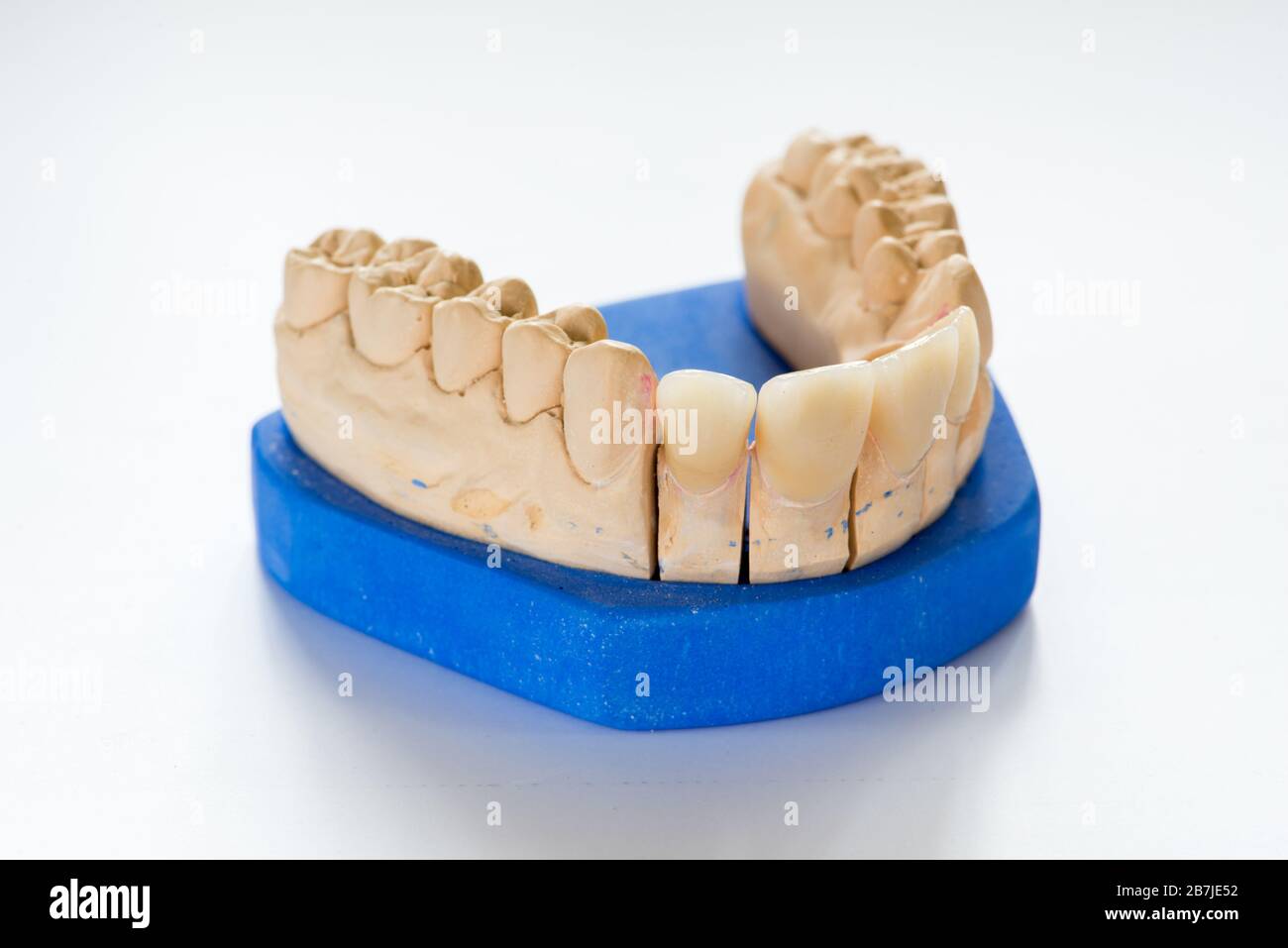 Dental gypsum model in dentist laboratory office - close-up. Gypsum ...