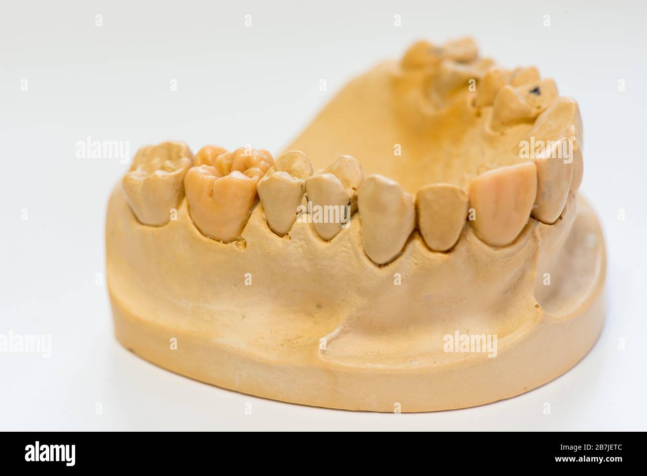 Dental gypsum model in dentist laboratory office - close-up. Gypsum ...
