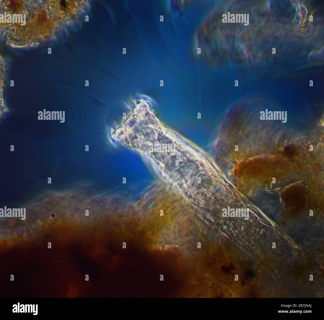 Darkfield photomicrograph, bdelloid rotifer, Philodina rotifer feeding ...