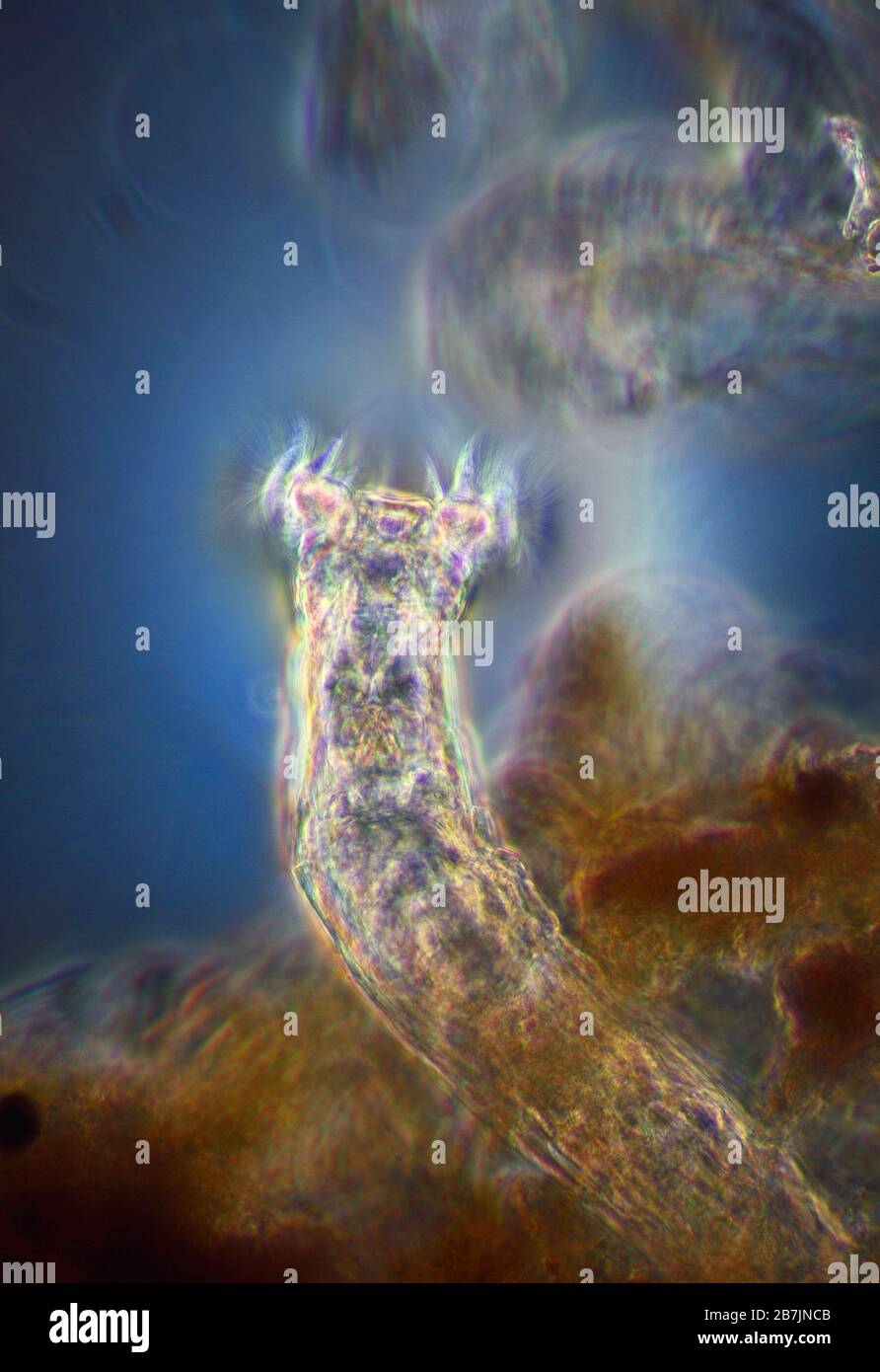 Darkfield photomicrograph, bdelloid rotifer, Philodina rotifer feeding ...