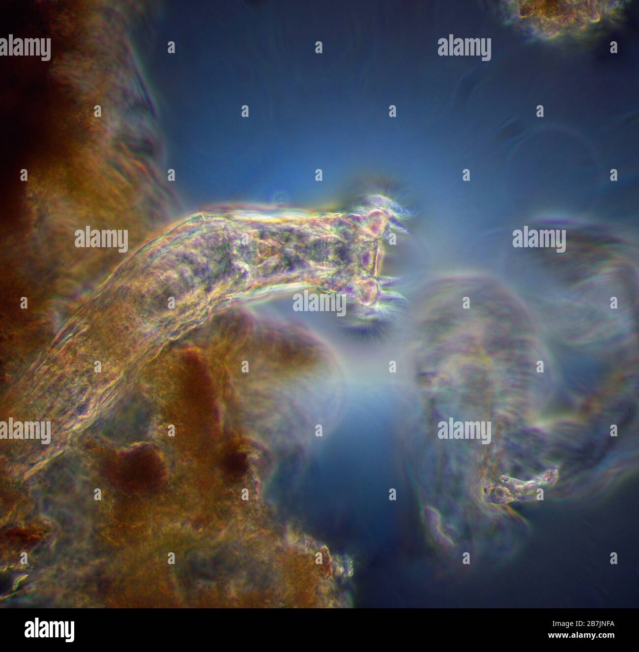 Darkfield photomicrograph, bdelloid rotifer, Philodina rotifer feeding ...