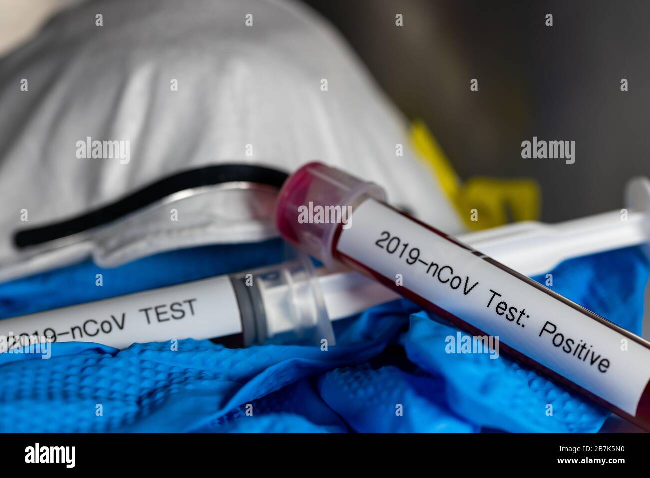 Positive blood test hi-res stock photography and images - Alamy