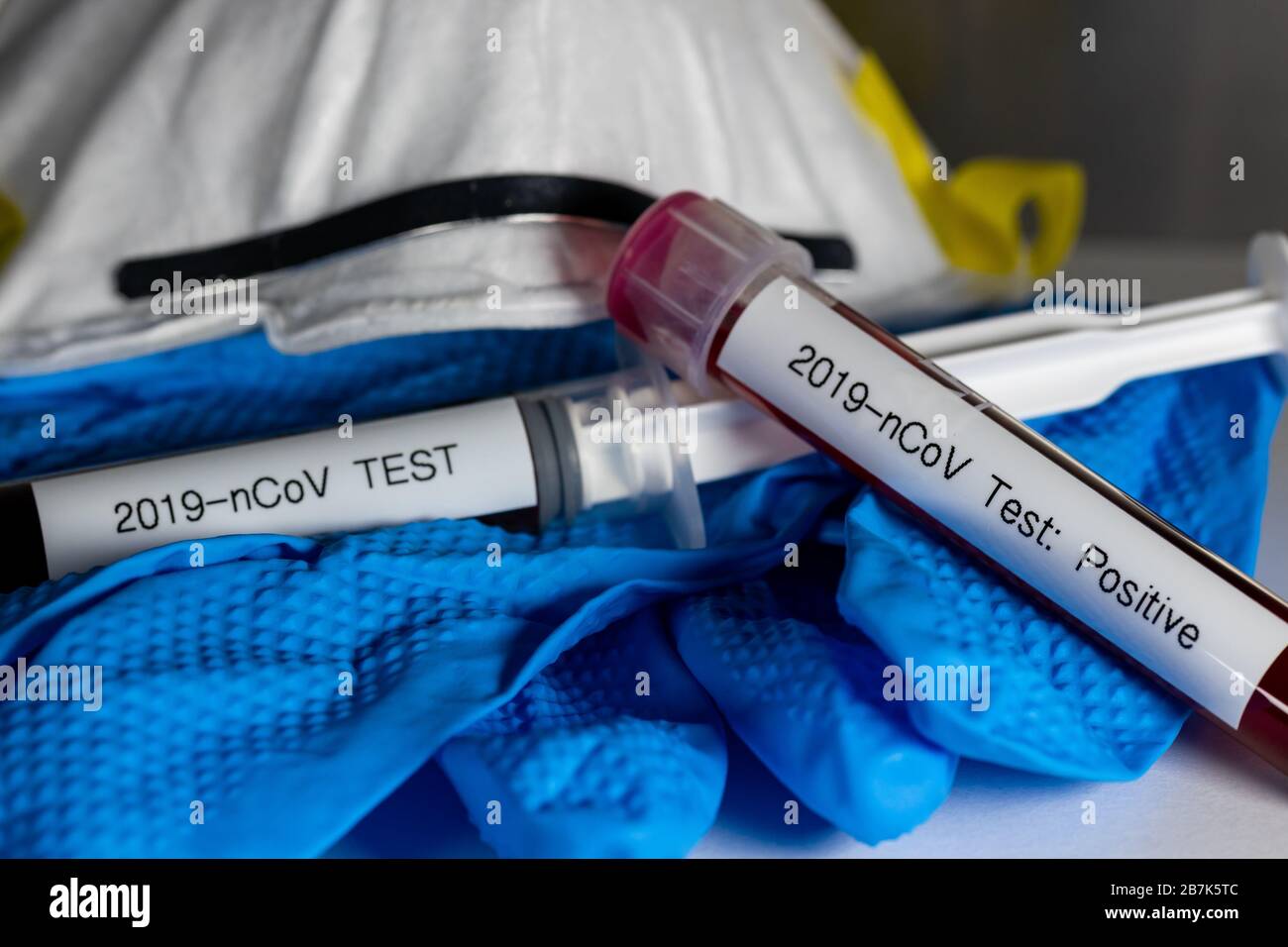 Blood test results hi-res stock photography and images - Alamy