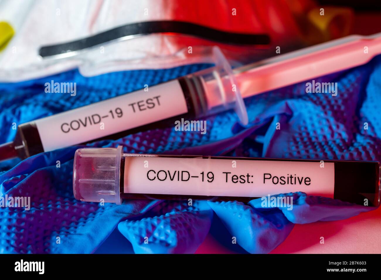 Positive blood test results for the covid-19 coronavirus Stock Photo ...