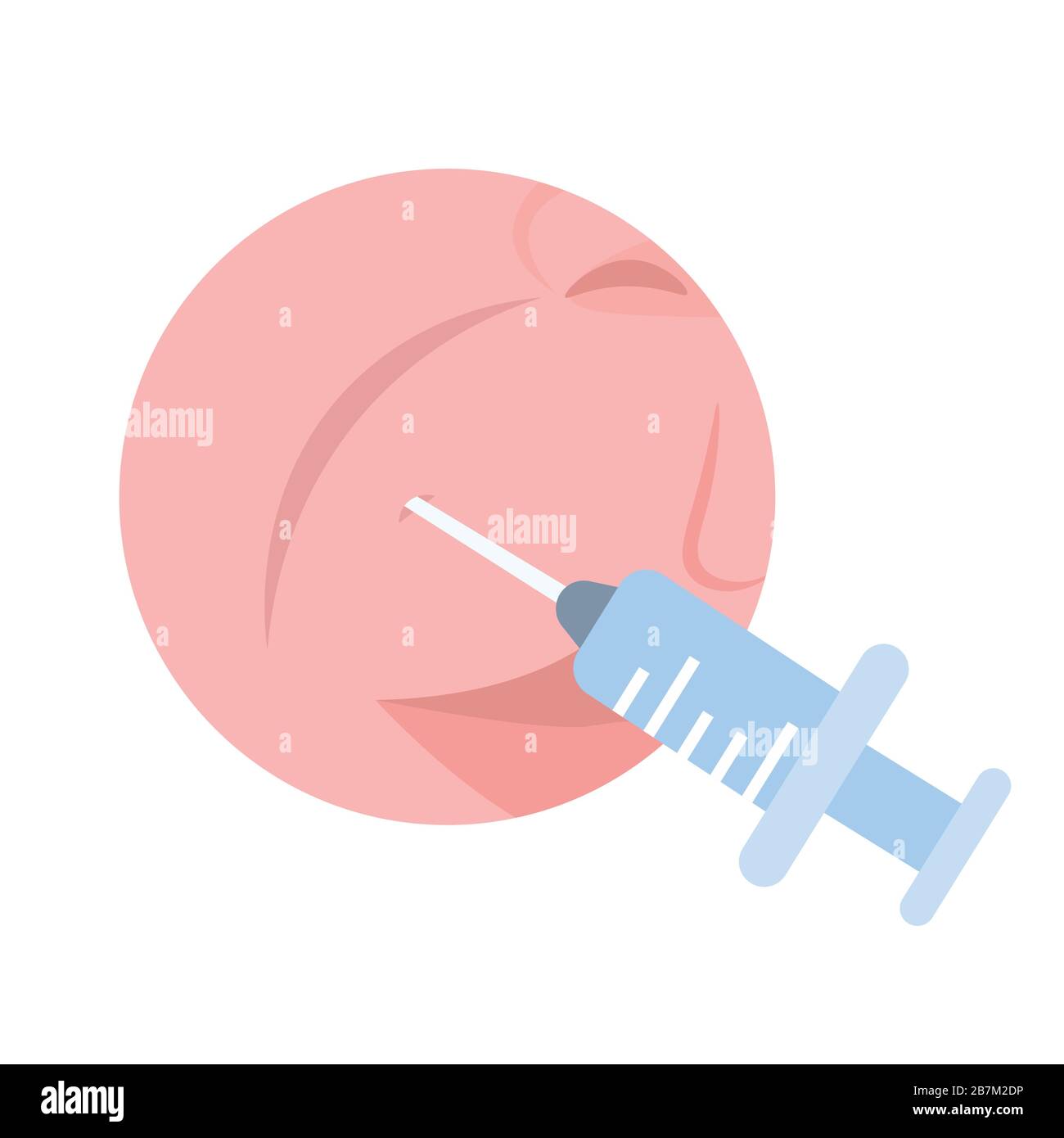 smile lines dermal hyaluronic acid filler rejuvenation injection ...