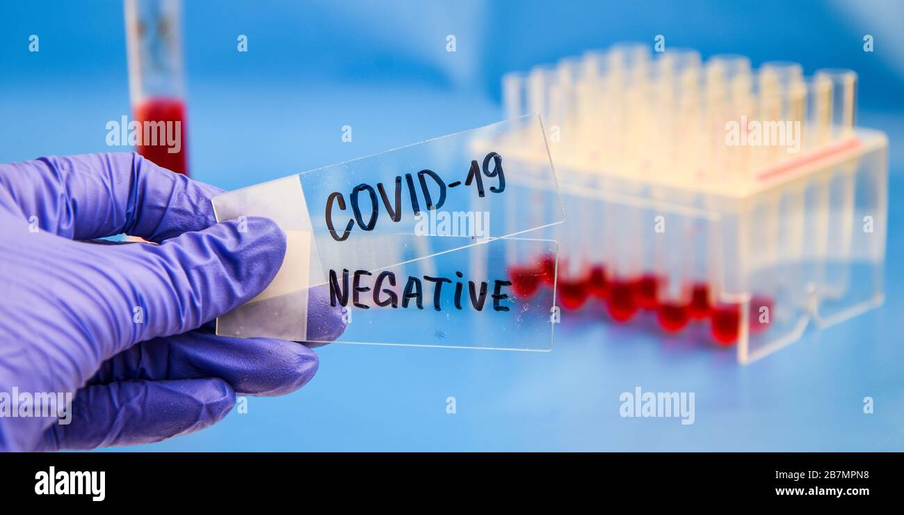Close up of microbiologist hand with surgical gloves holding a negative ...
