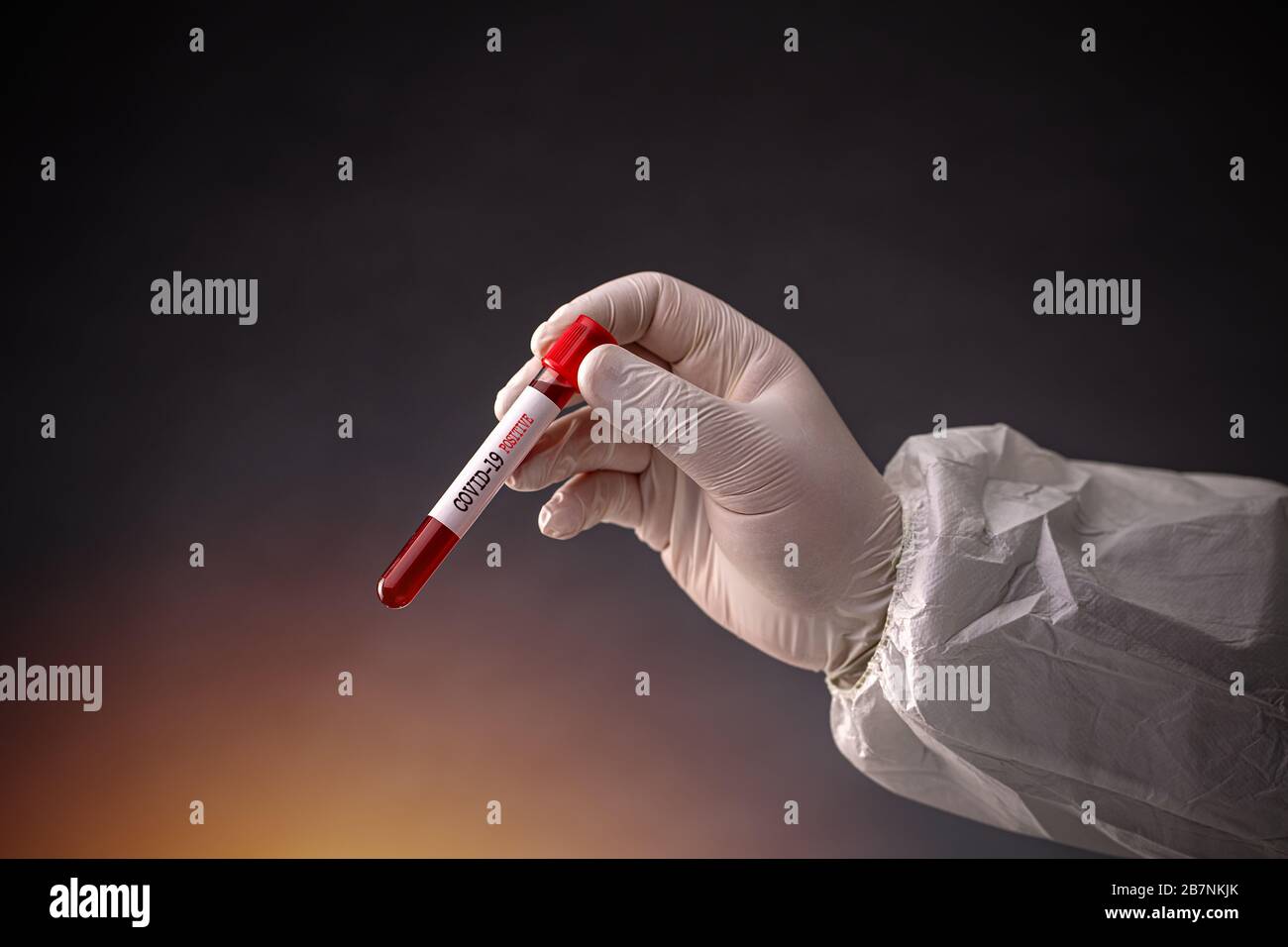 Sample tube hi-res stock photography and images - Alamy