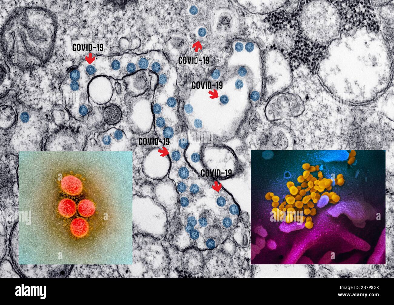 Flu virus scanning electron microscope hi-res stock photography and ...