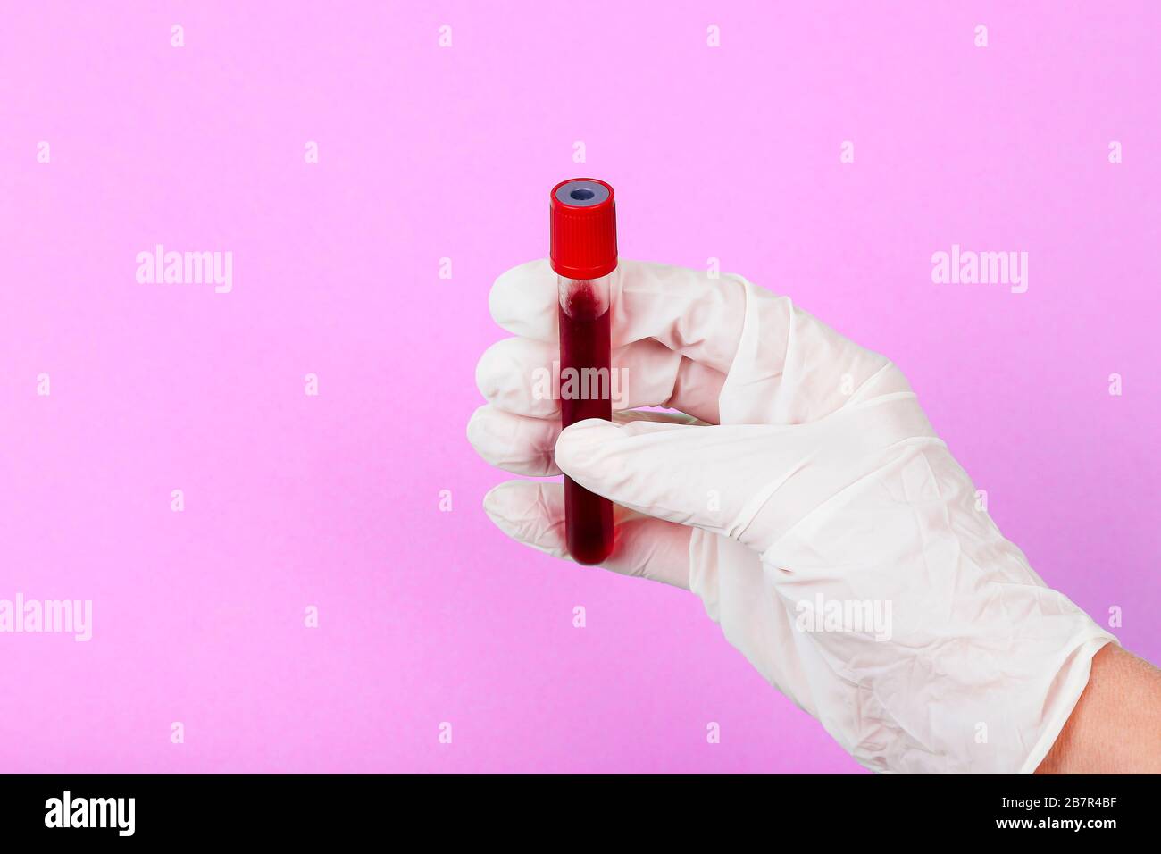 Hand Holding Blood Sample in Test Tube. Coronavirus Concept Stock Photo ...