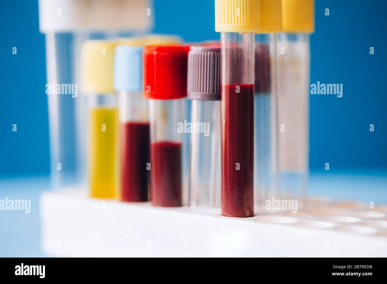 blood tubes in the tray Stock Photo - Alamy