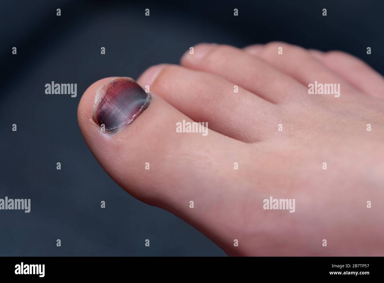 Red colored feet nails hi-res stock photography and images - Alamy