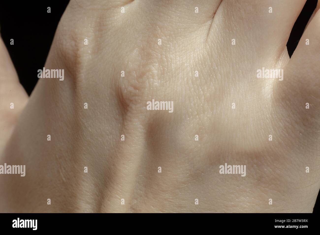 Hands. Detailed texture of human skin. Close up shot of young caucasian ...
