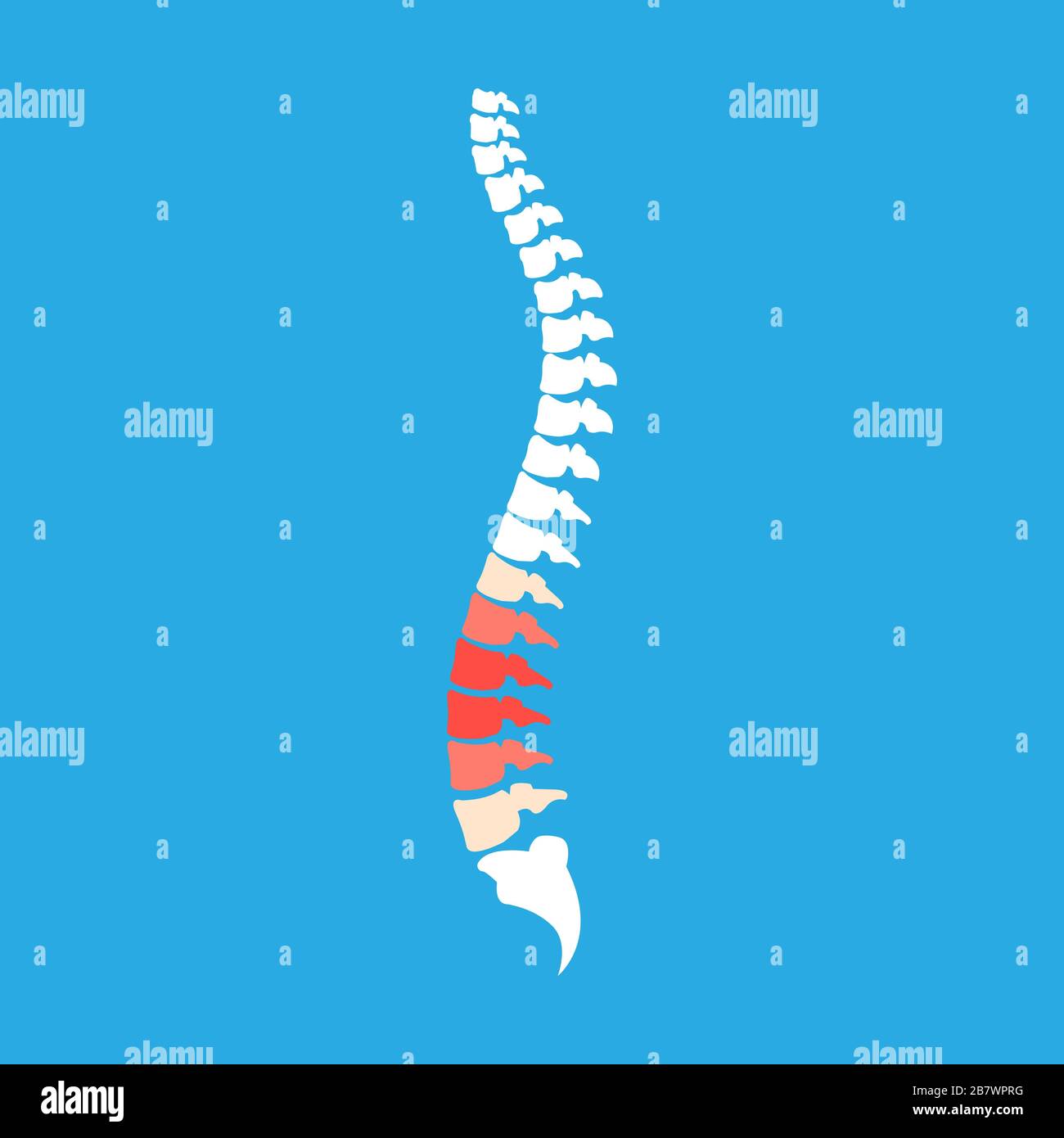 Sciatica pain anatomy Stock Vector Images - Alamy