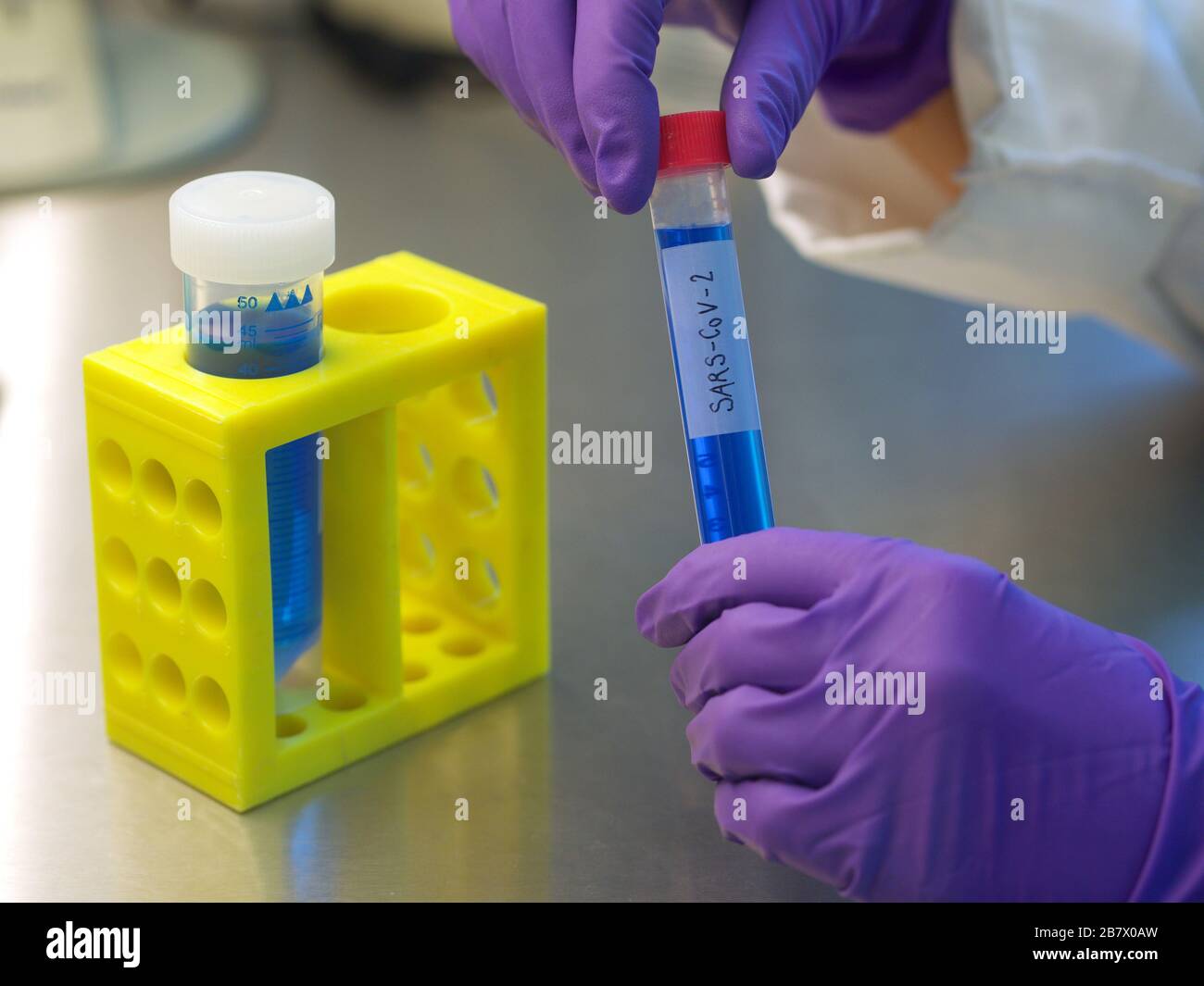 Elisa test hi-res stock photography and images - Alamy