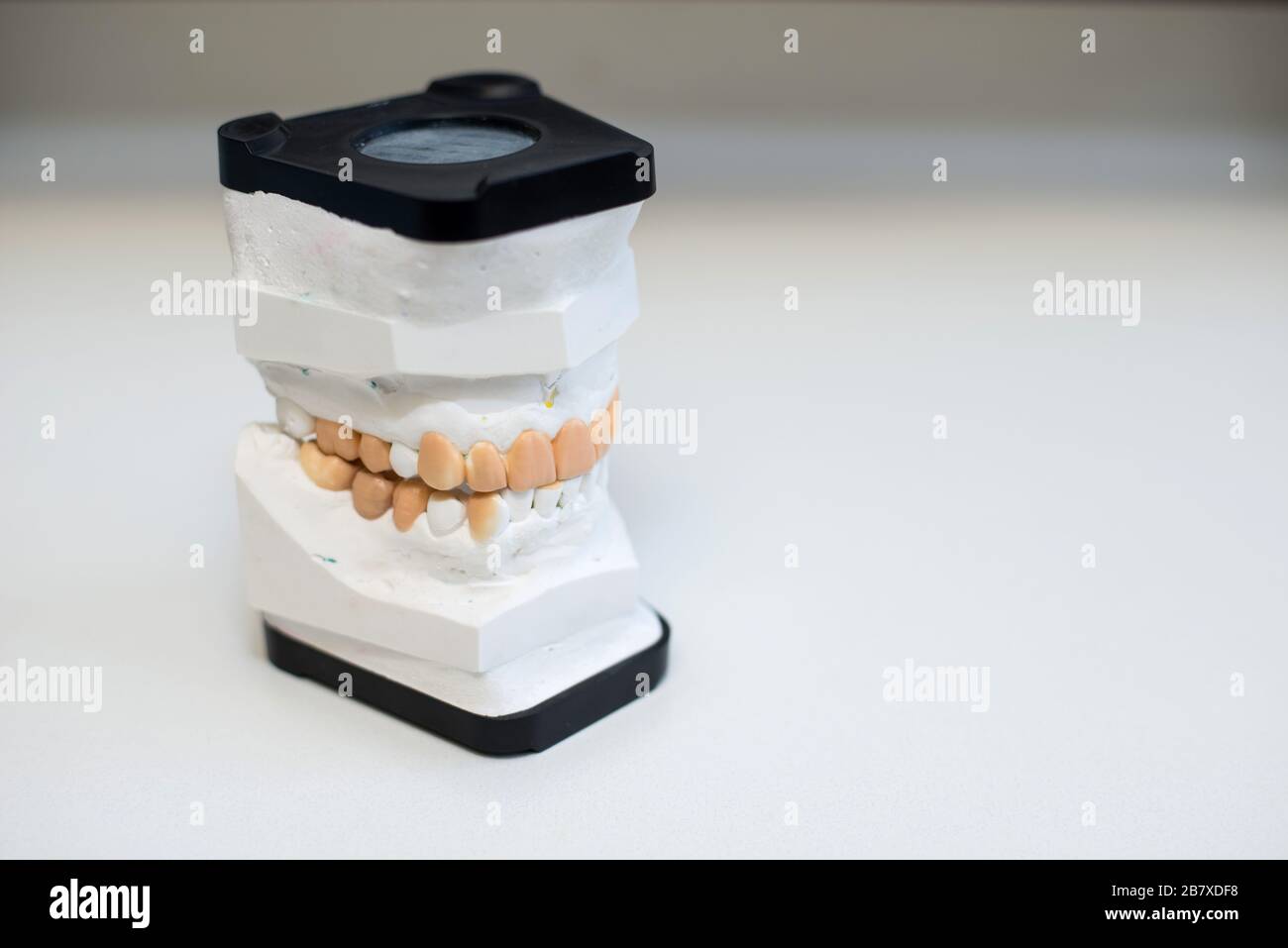 dental gypsum models, dentist's office Stock Photo - Alamy