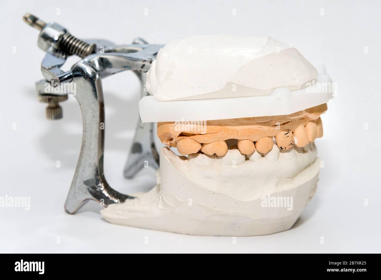 Plaster Cast of jaws. Dental casting gypsum model human Jaws in ...