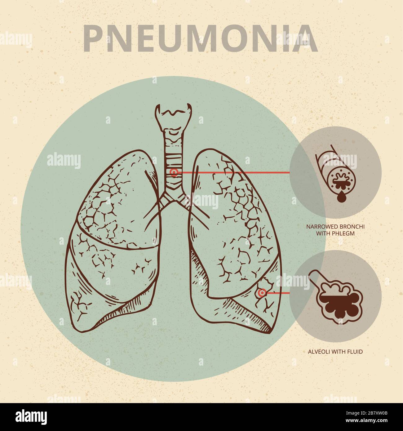 A schematic illustration of the human body with an infographic of the ...