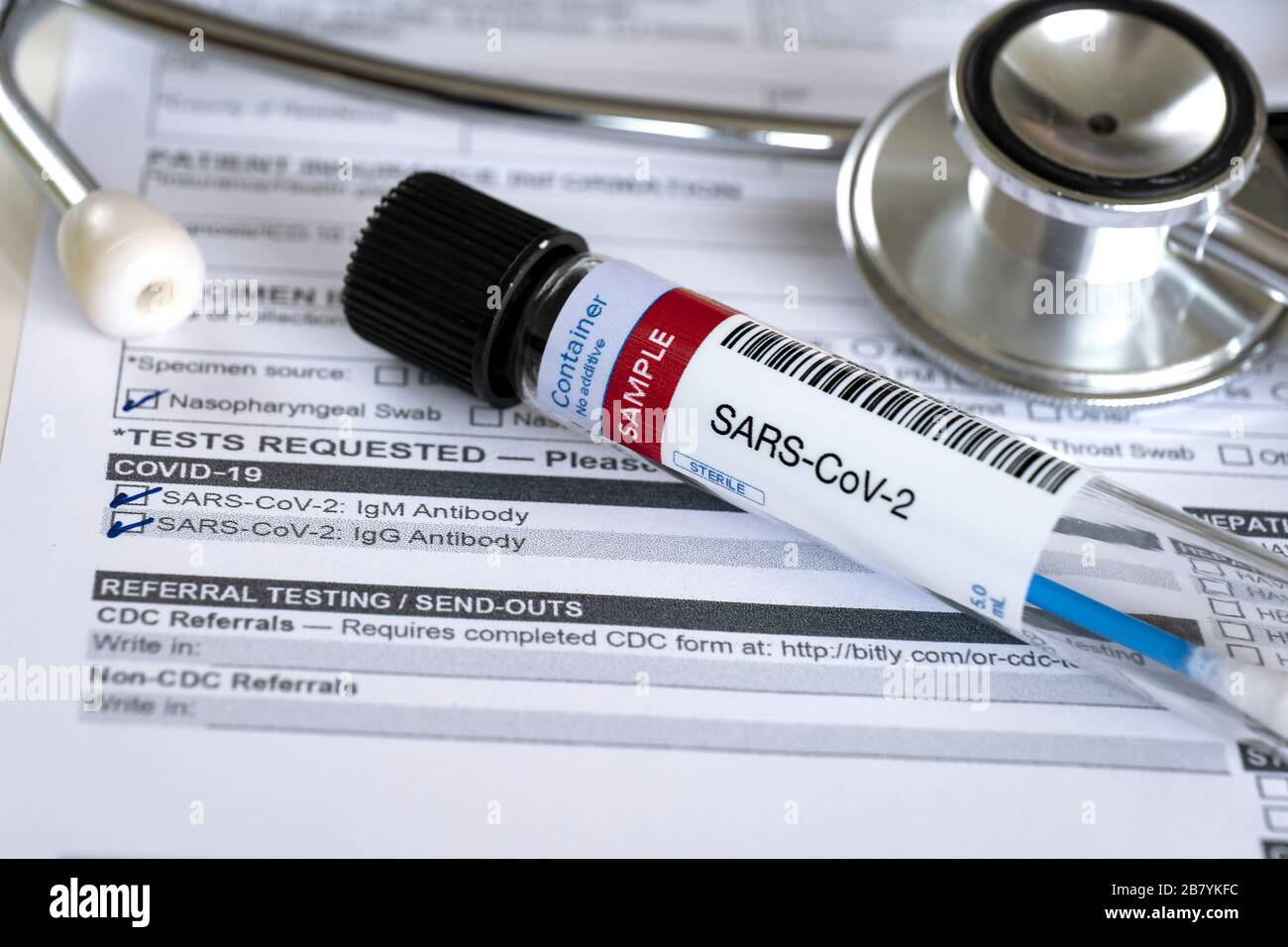 Testing for presence of coronavirus. Tube containing a swab sample for ...