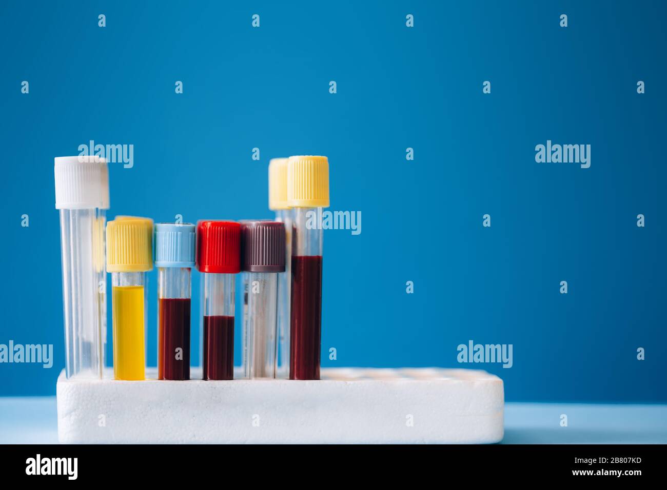 blood tubes in the tray Stock Photo - Alamy