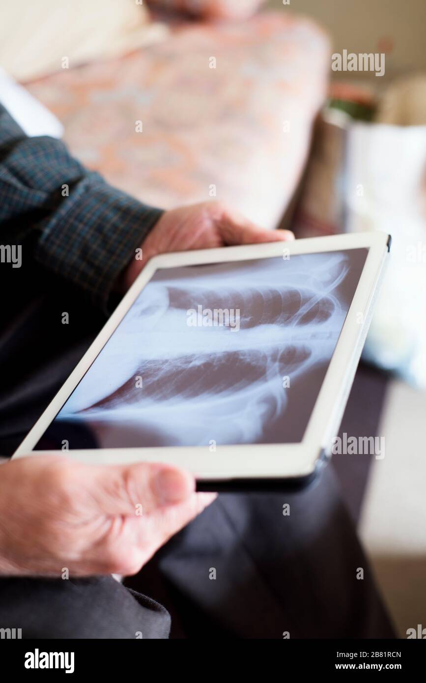 Cancer monitoring hi-res stock photography and images - Alamy