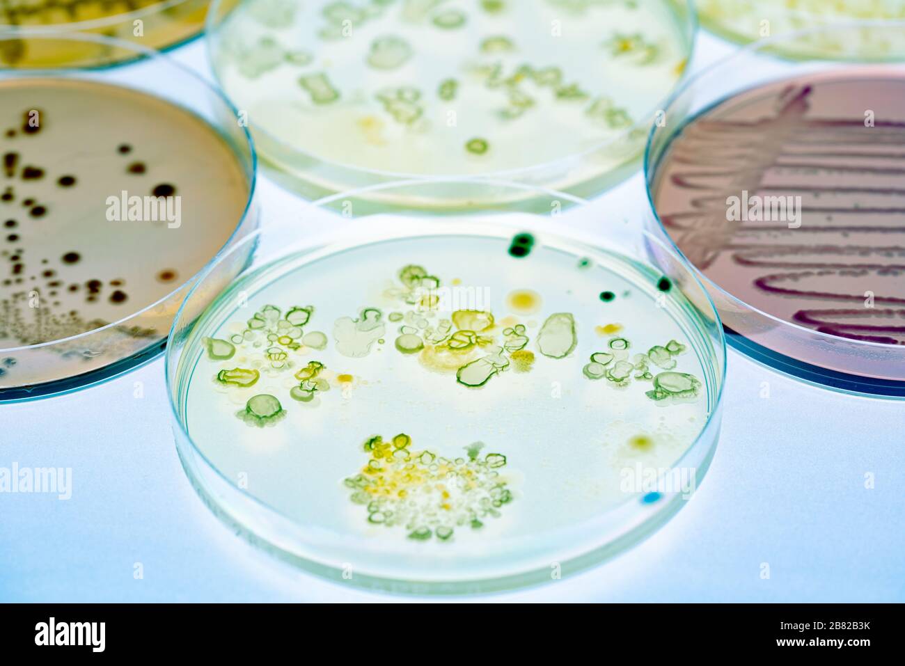Mixed bacteria colonies hi-res stock photography and images - Alamy