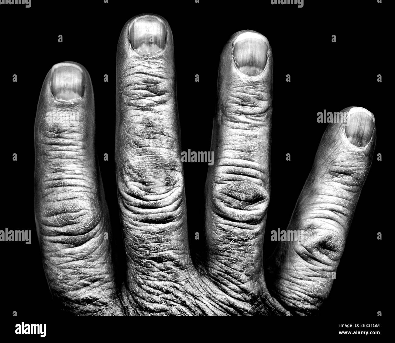 Human fingers anatomy hi-res stock photography and images - Alamy