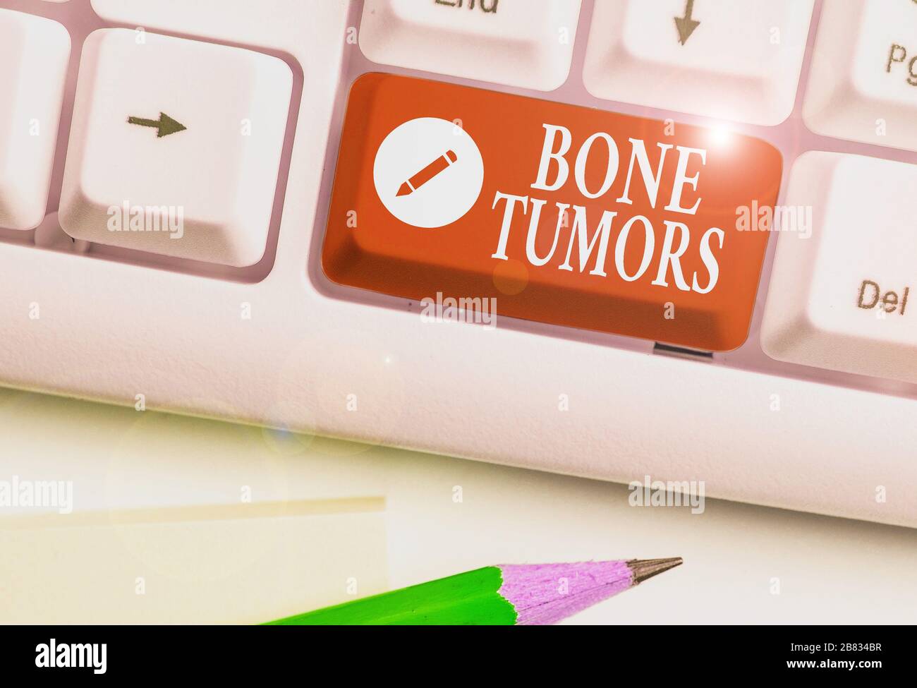 Bone tumors hi-res stock photography and images - Alamy