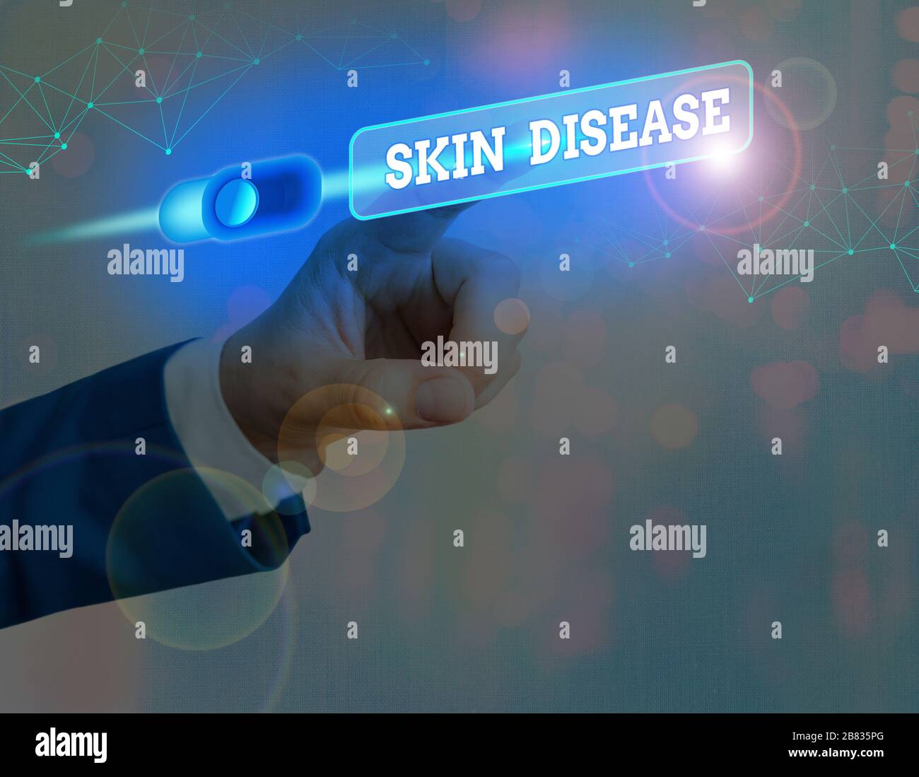 Word writing text Skin Disease. Business photo showcasing any of the ...