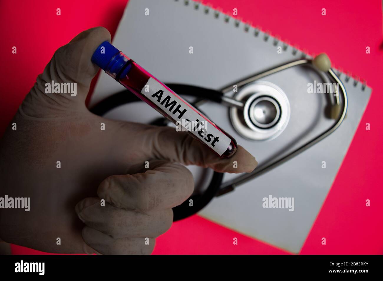 AMH - Test with blood sample. Top view isolated on office desk ...