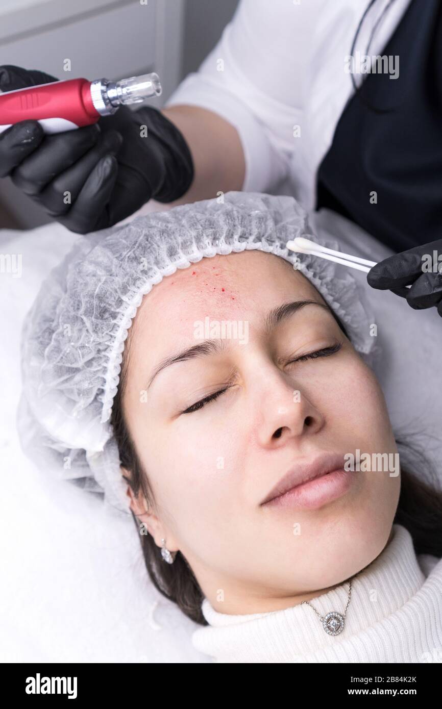 Cosmetologist making mesotherapy injection. Microneedle mesotherapy ...