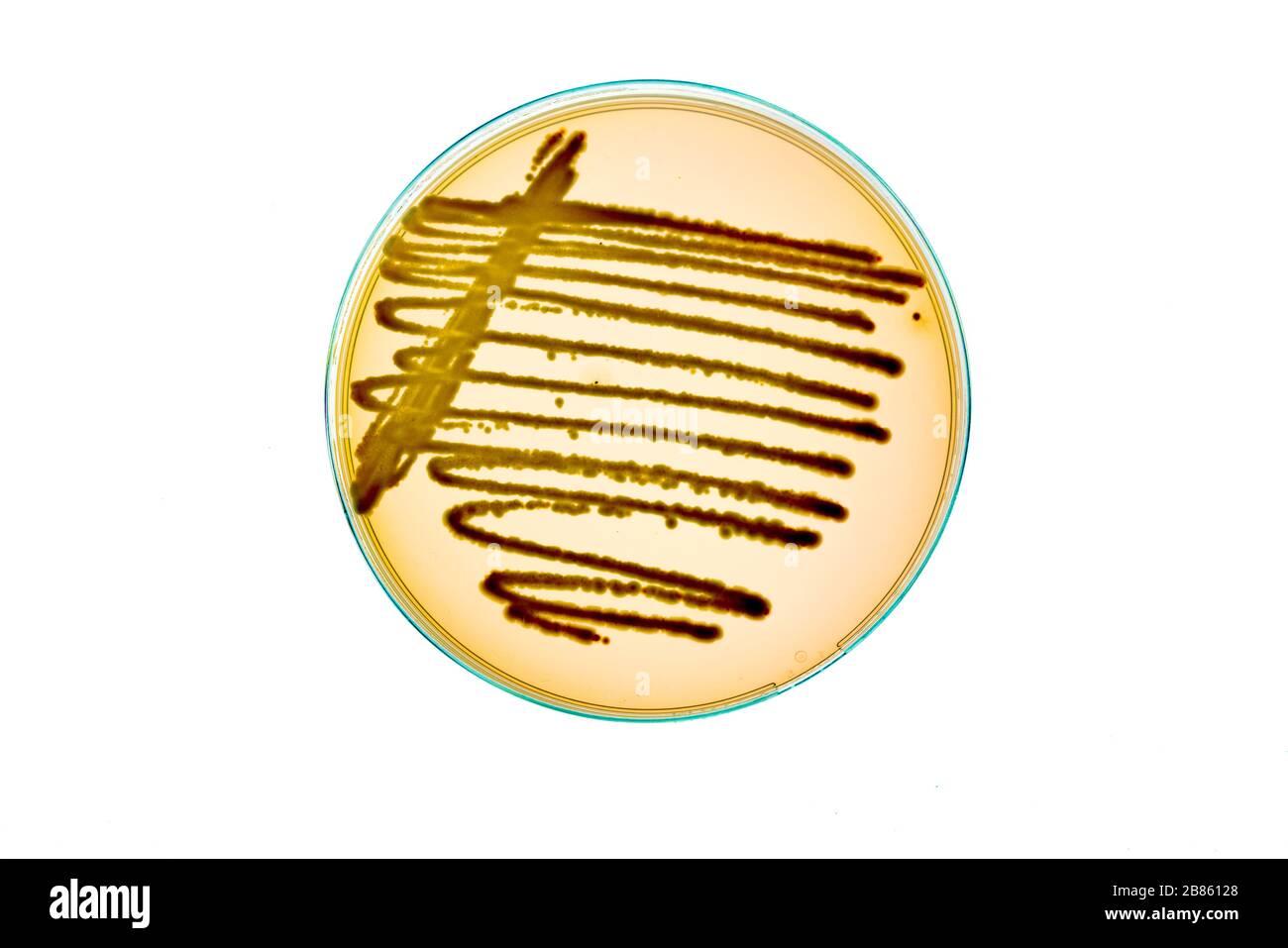 Growing Bacteria in Petri Dishes on agar gel Scientific experiment ...