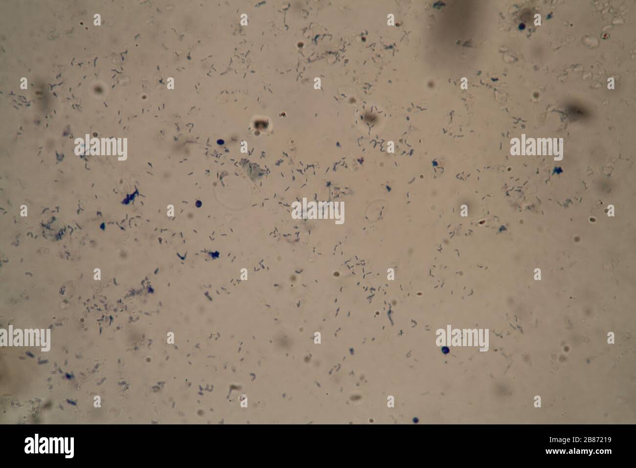 Tuberculosis bacteria under the microscope 400x Stock Photo - Alamy