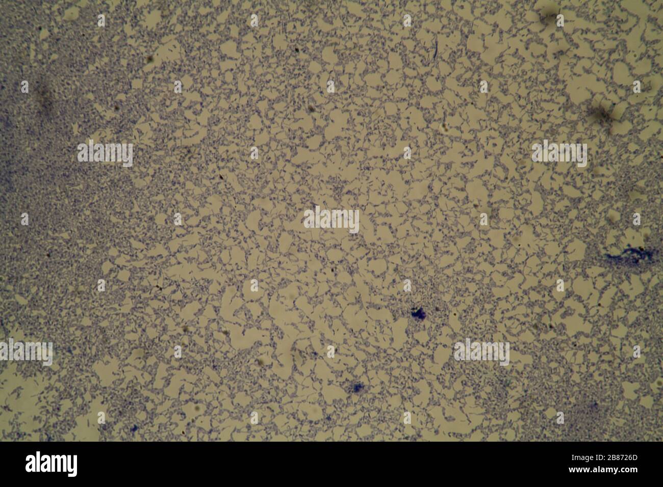 Salmonella pathogen under the microscope 200x Stock Photo - Alamy