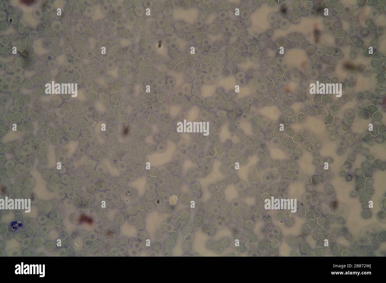 Malaria parasites in red blood cells under the microscope 400x Stock ...