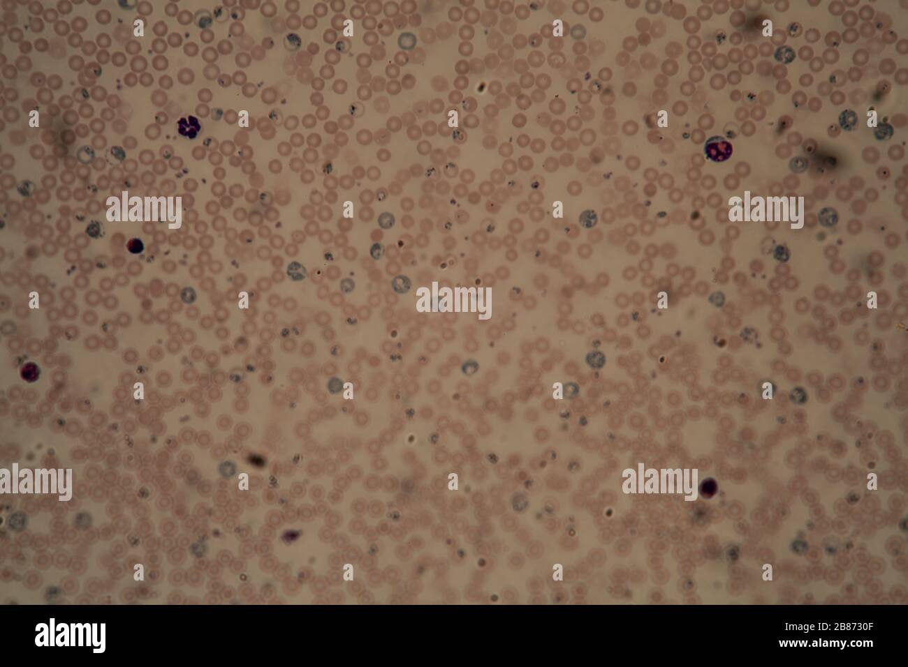 Malaria parasites in red blood cells under the microscope 400x Stock ...