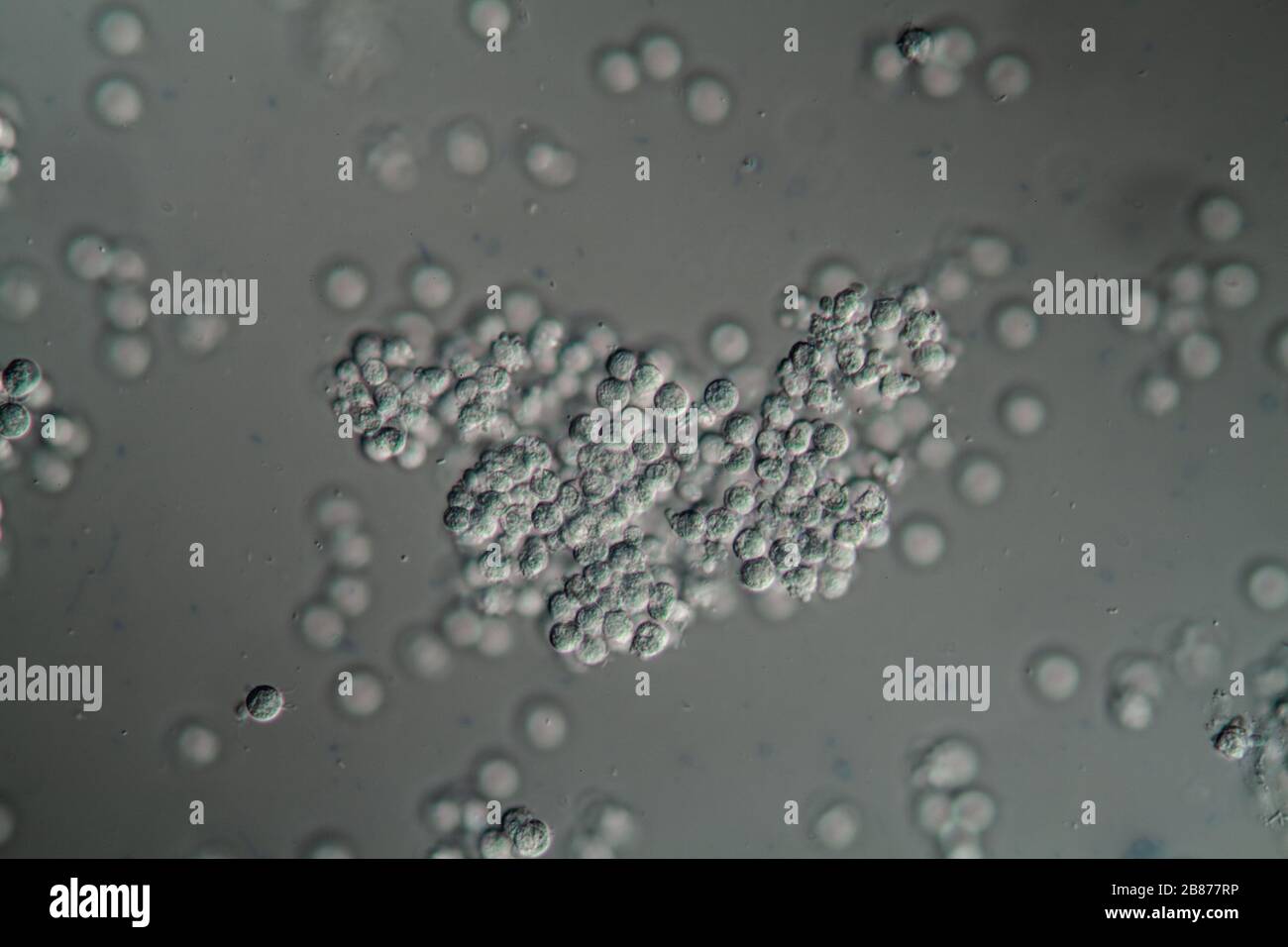 Mucosal cell epithelium from the human bladder wall 400x Stock Photo ...