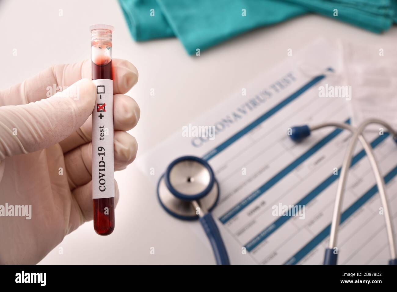 Medical professional with tube with covid-19 infected blood sample on ...