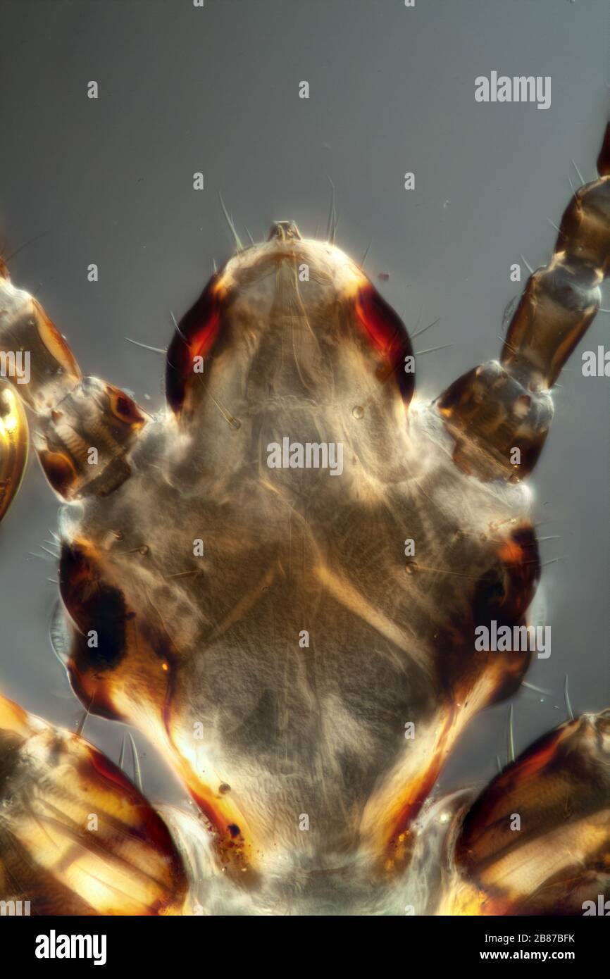 Head of the head louse with sucking mouth tools Stock Photo - Alamy
