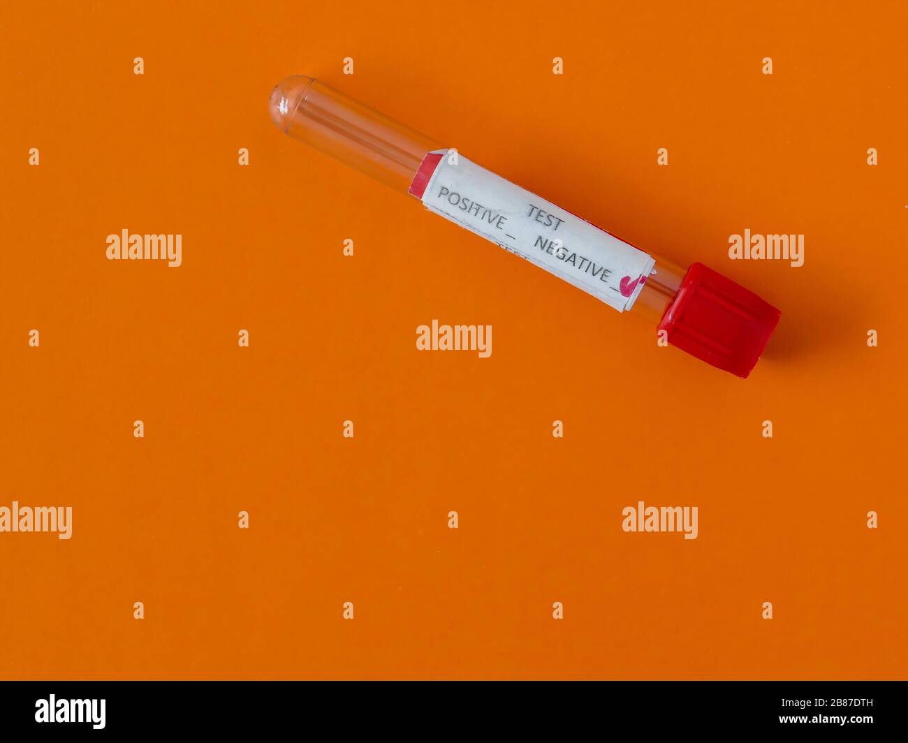 Positive and negative bacteria hi-res stock photography and images - Alamy