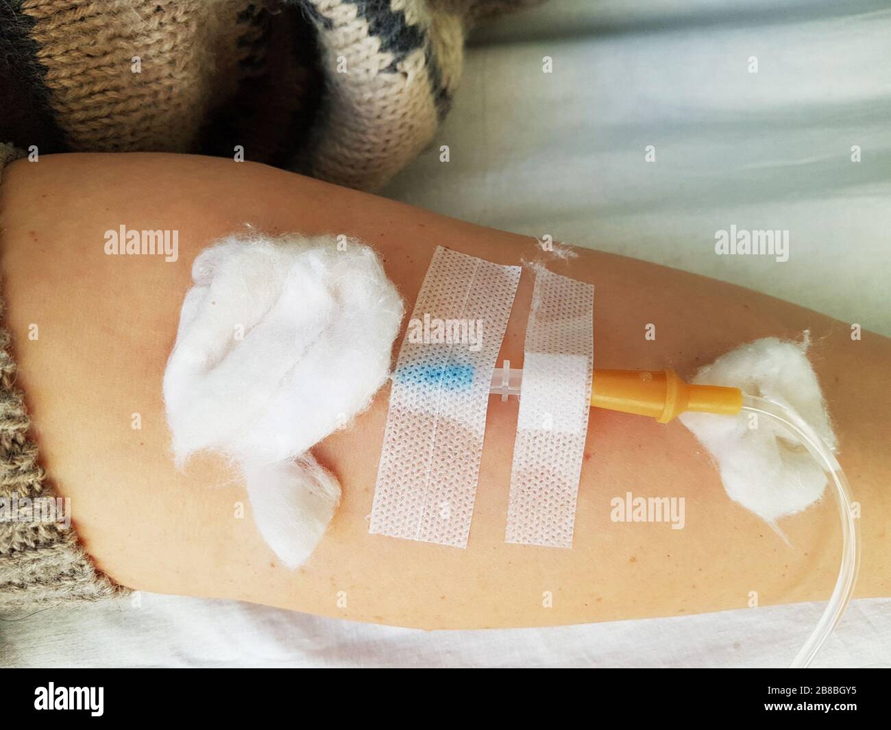 A woman is given an intravenous dropper in her hand. Closeup soft focus ...