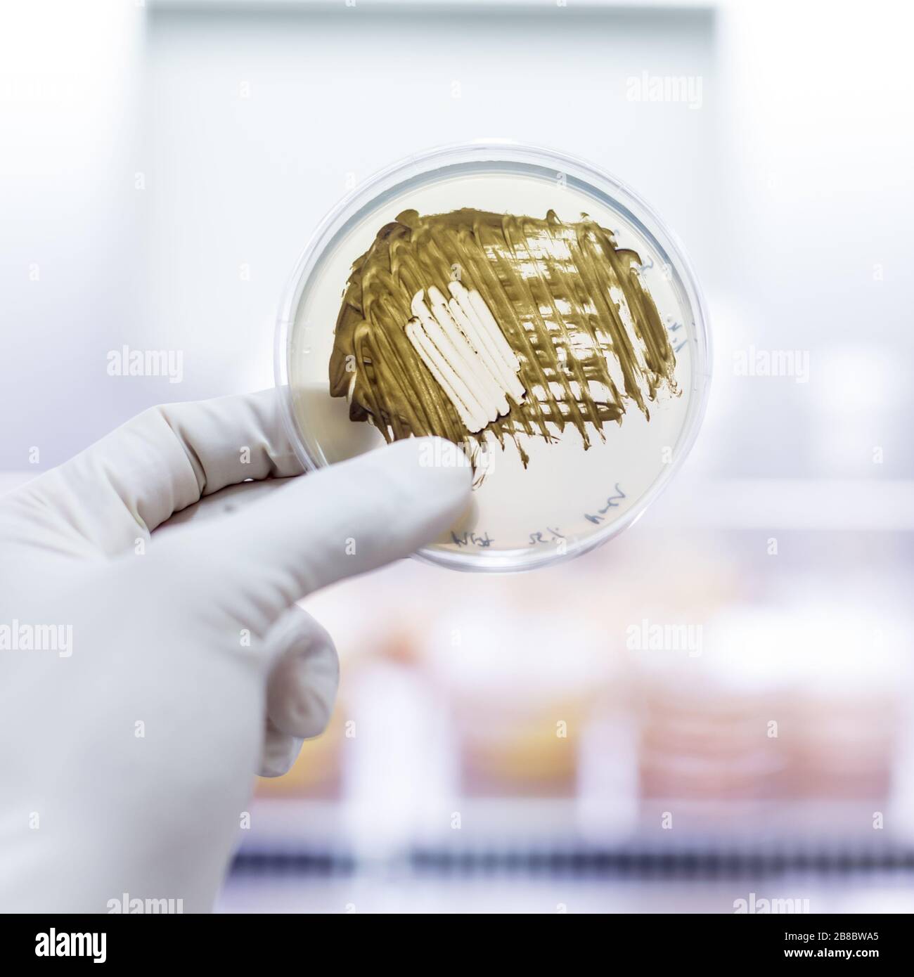 Scientist growing bacteria in petri dishes on agar gel as a part of ...